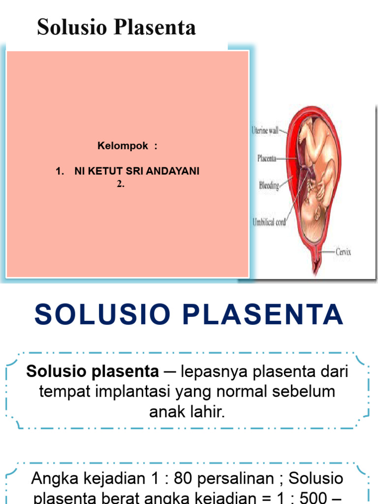 Solusio-Plasenta | PDF