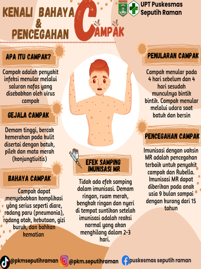 Kenali Campak | PDF