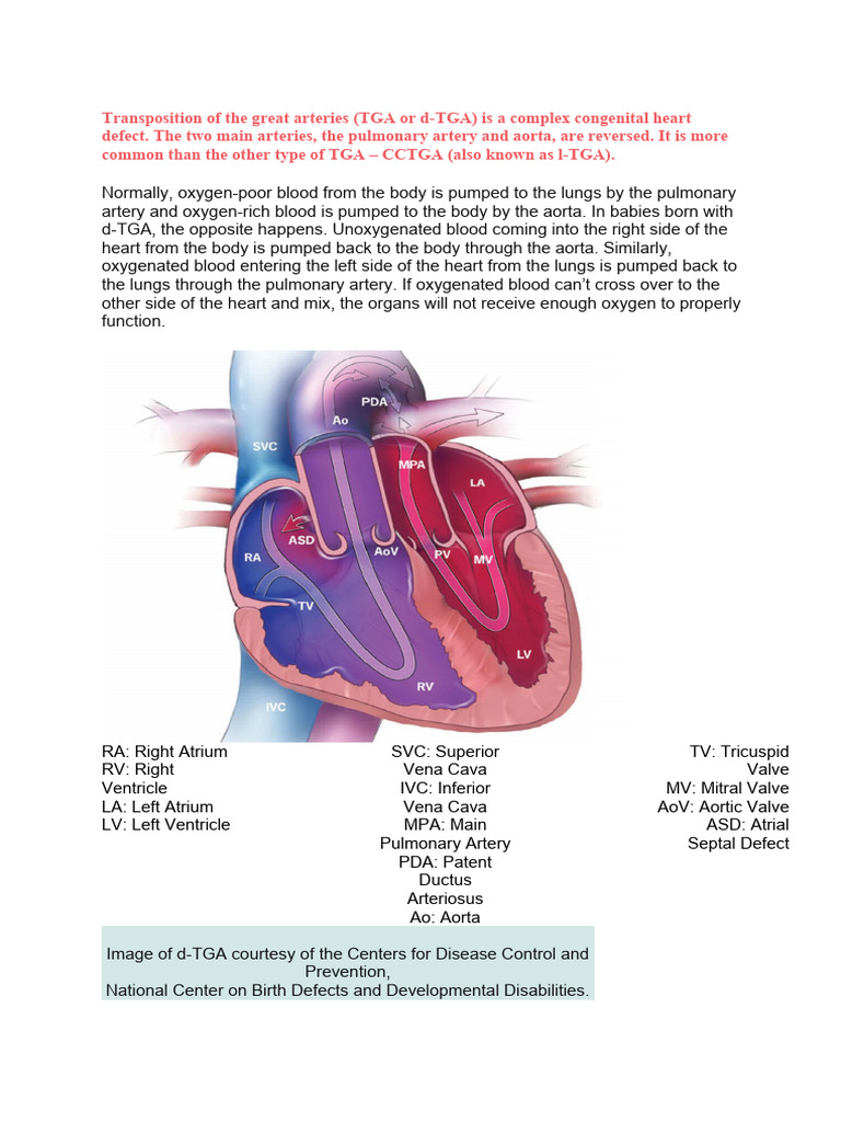 Transposition of The Great Arteries | PDF