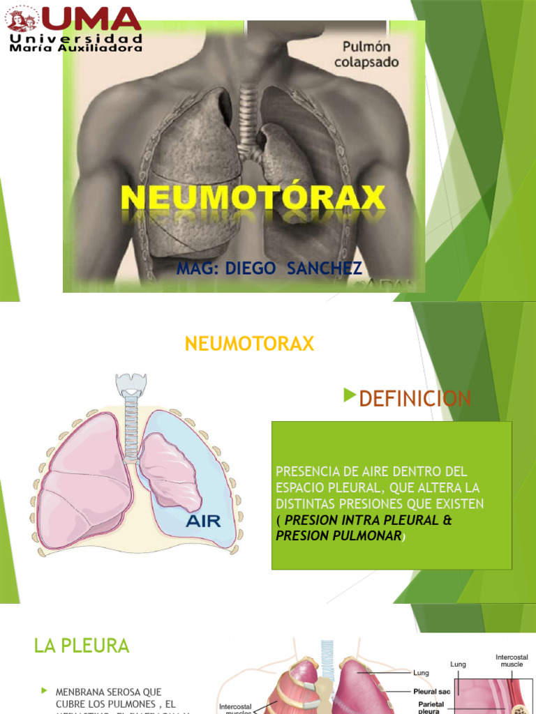 Presentación4 NEUMOTORAX | PDF