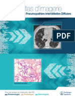 Scanner TDM Thoracique en Coupes | PDF | Aorte | Thorax