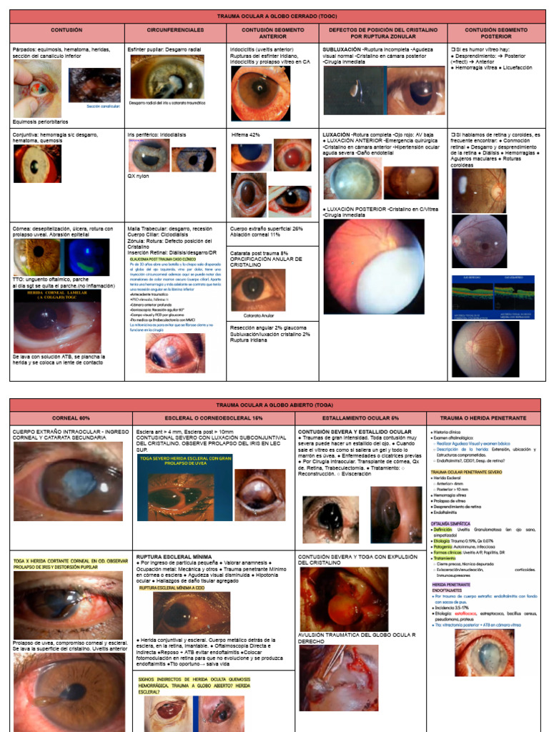 Trauma Ocular Abierto y Cerrado | PDF