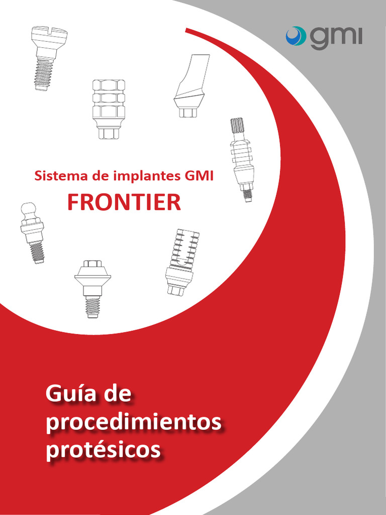 EMM0E0001 Guia Protesica Frontier ES | PDF