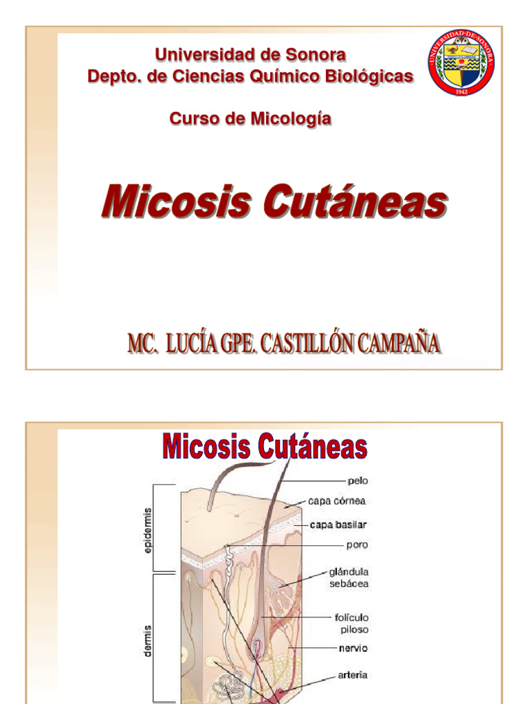 Micosis Cutáneas Pdf Especialidades Medicas Micología