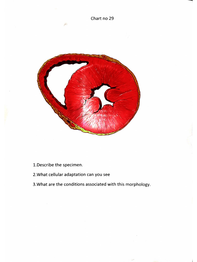 Pathology Charts - 1 | PDF