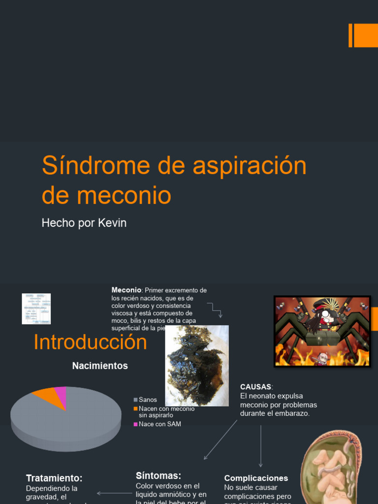 Síndrome de Aspiración de Meconio | PDF