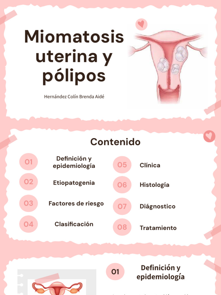 Miomatosis Uterina | PDF | El embarazo | Estrógeno