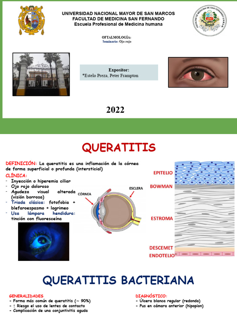 Guía sobre Queratitis: Tipos y Tratamientos | PDF