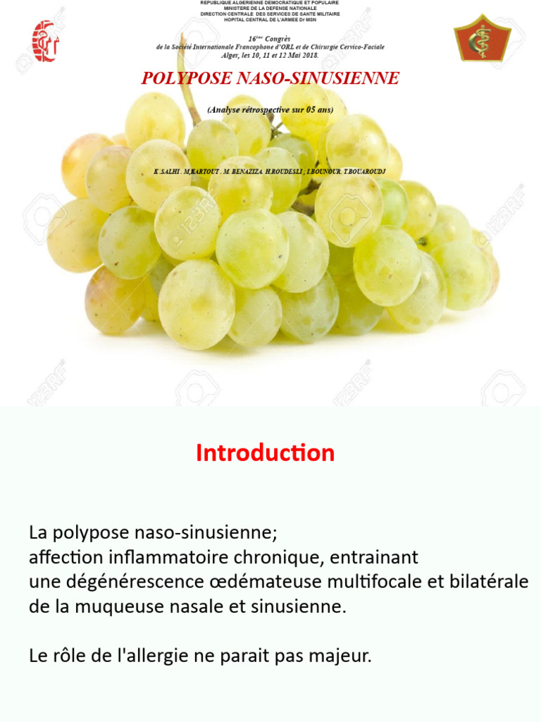 Polypose Naso Sinusienne Annalyse Retrospective 5 Ans HCA | PDF