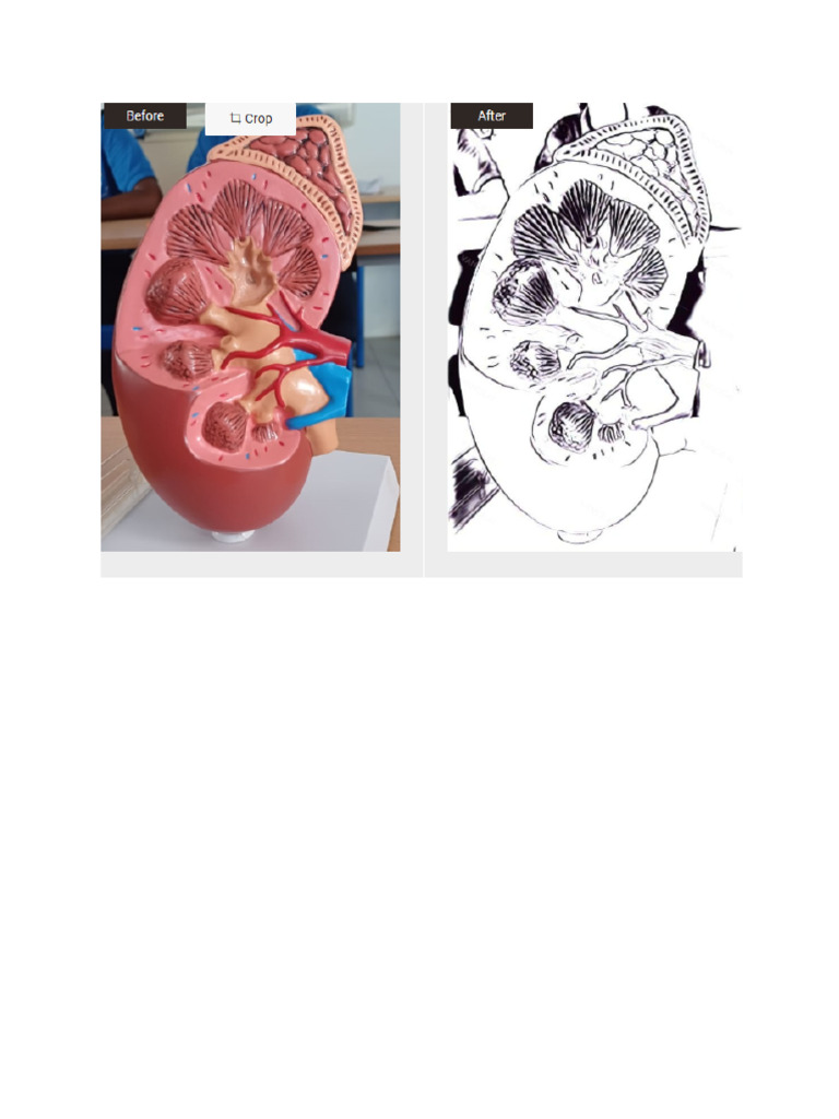 Drawing of Kidney | PDF