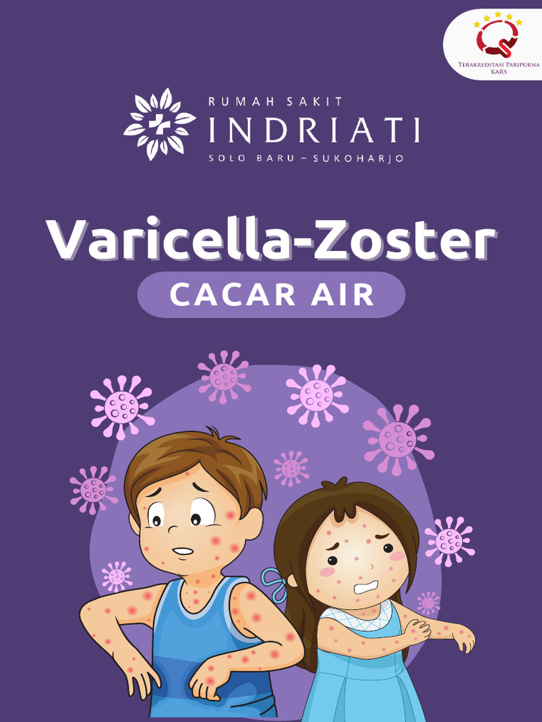 Varicella | PDF