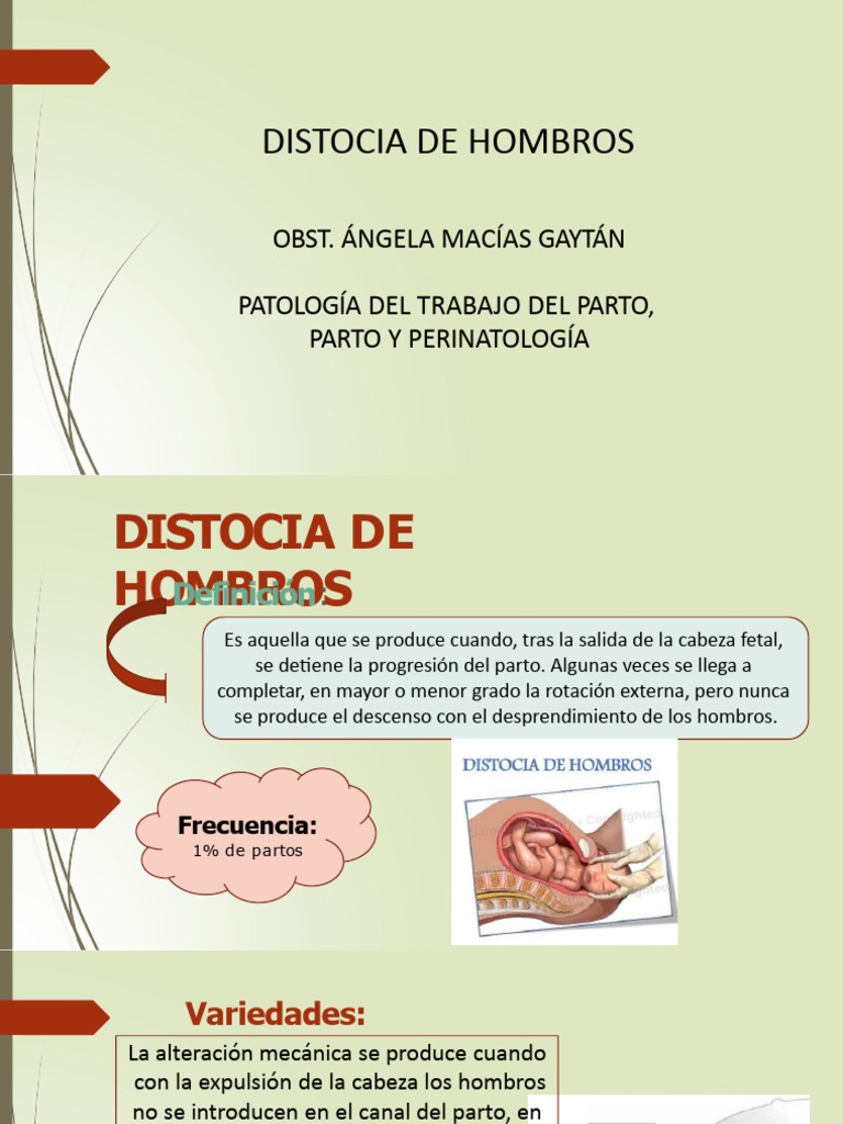 Distocia de Hombros | PDF | Parto | Pelvis