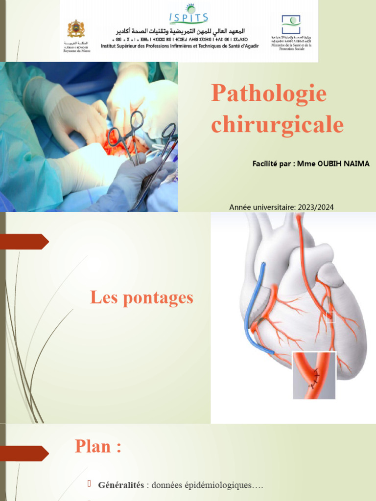 Pathologie Chirurgicale - Copie-1 | PDF | Cancer du poumon | Pontage coronarien