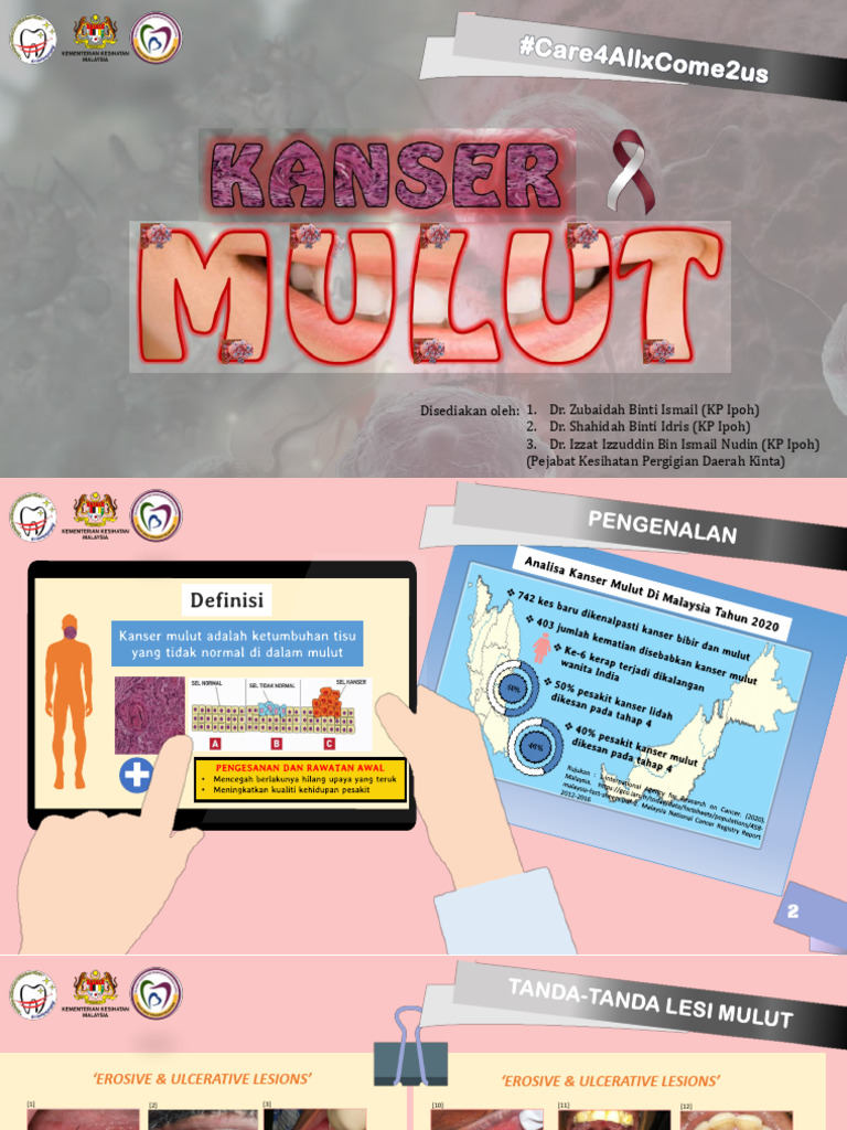 Kanser Mulut - KP Ipoh PDF 2 | PDF