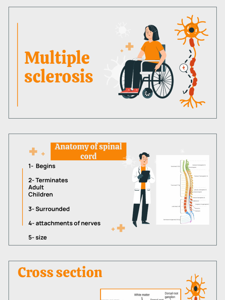 Multiple Sclerosis | PDF