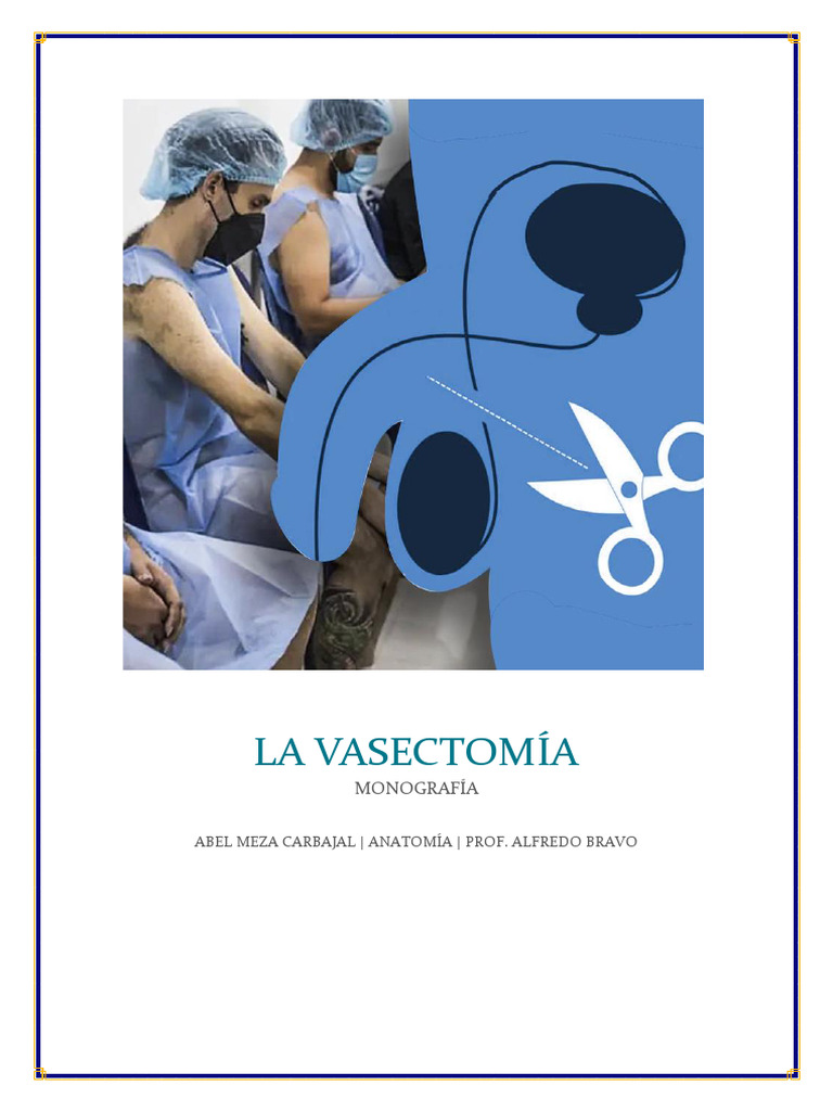 Vasectomía: Procedimiento y Efectividad | PDF