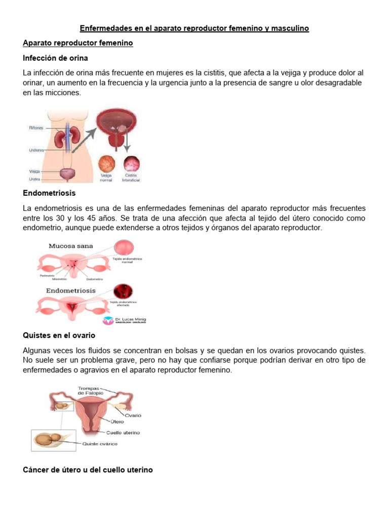 Enfermedades en El Aparato Reproductor Femenino y Masculino | PDF | Sistema reproductivo | Salud ...