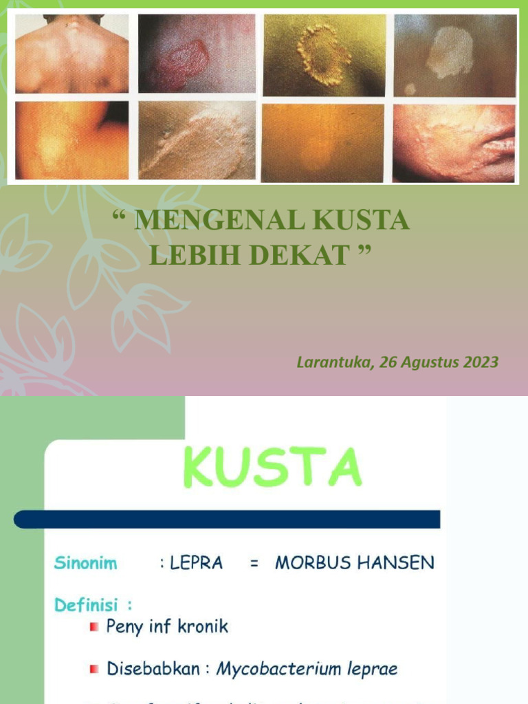 Materi Kusta | PDF