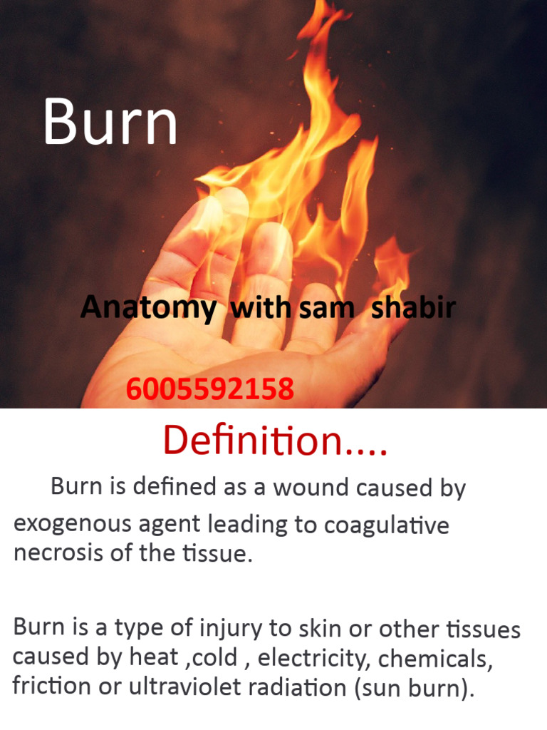 Burn by Sam Sir | PDF | Technology & Engineering