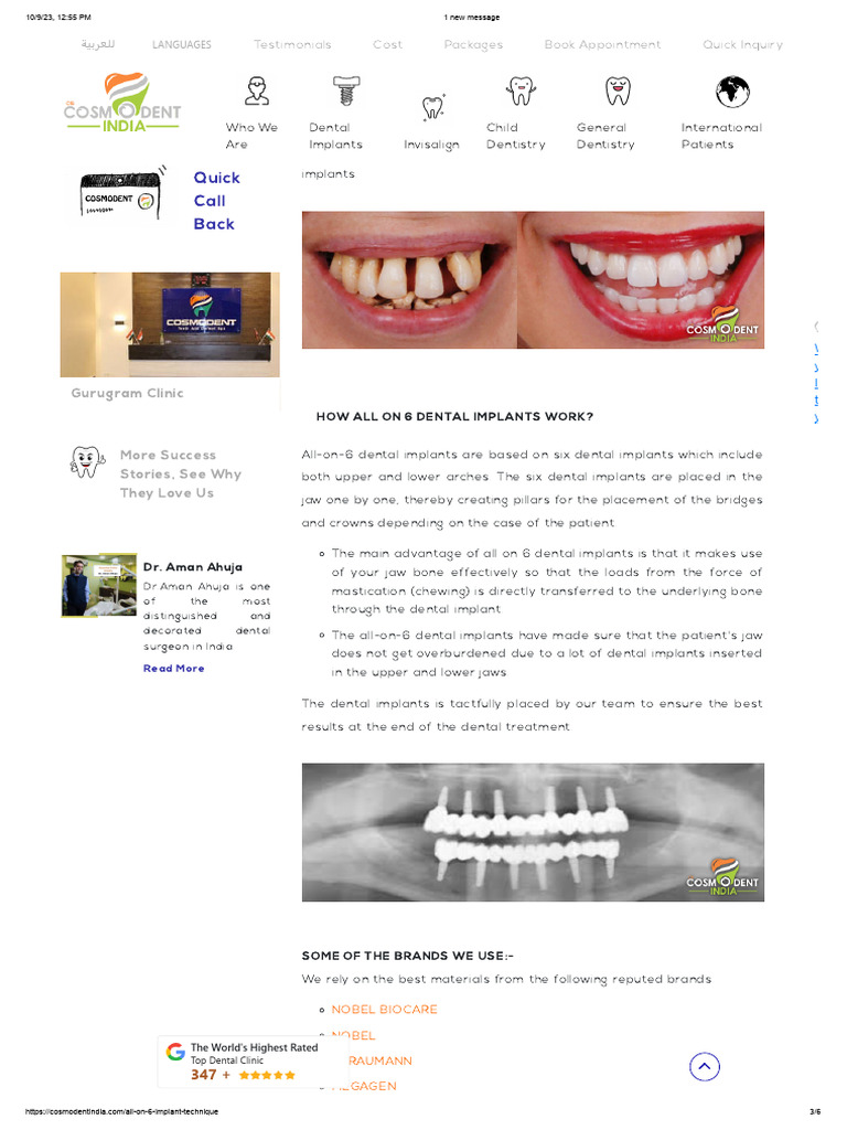 All On Six Dental Implants | PDF