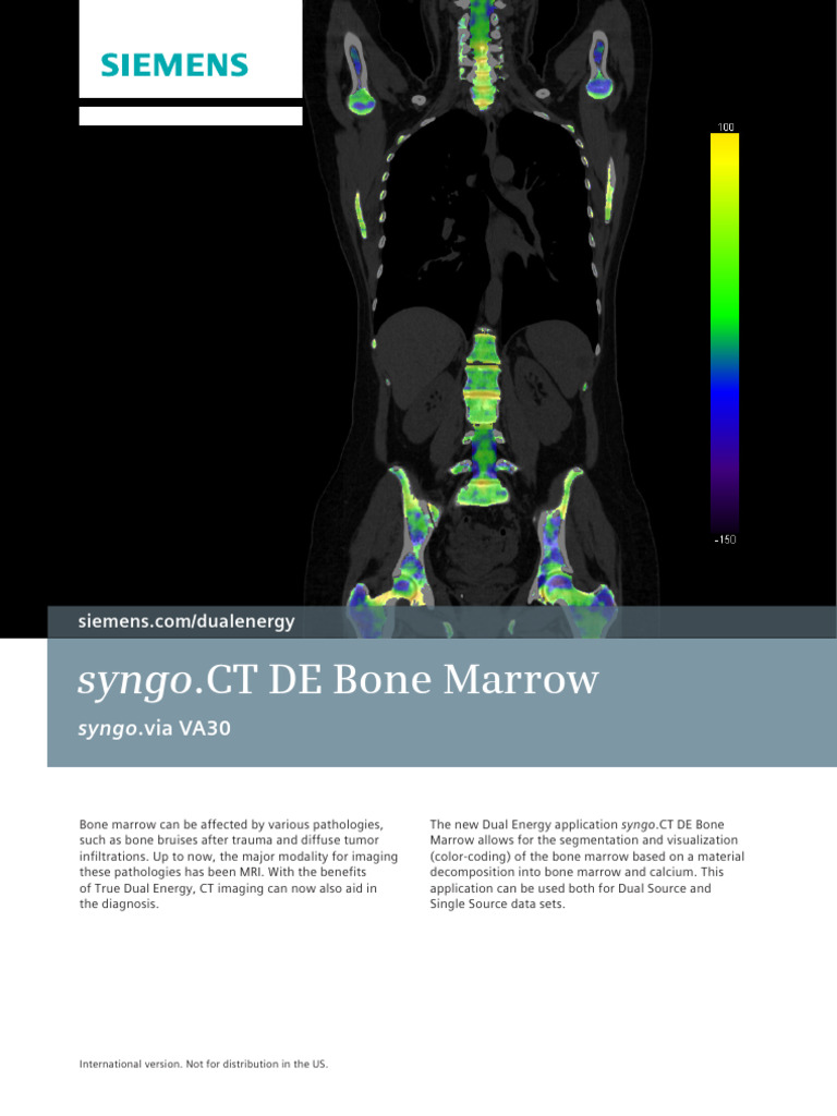 DE Bone Marrow VA30 syngoCT | PDF | Ct Scan | Medical Imaging