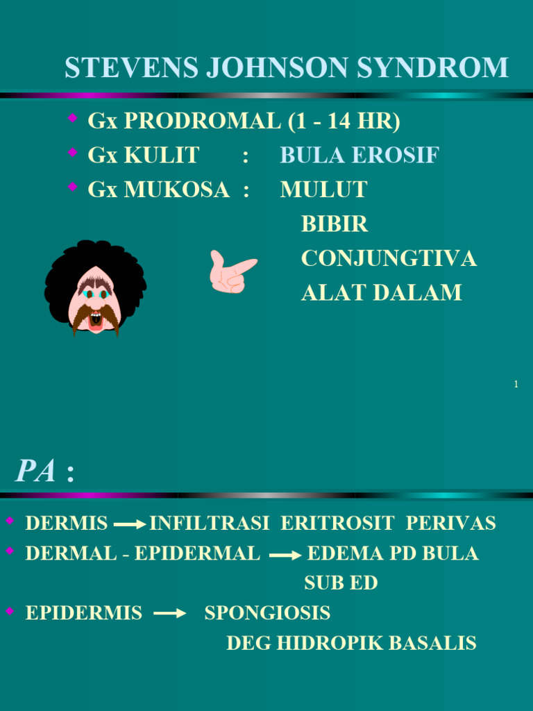 Handouts STEVENS JOHNSON SYNDROM | PDF