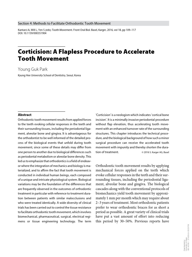 Corticision A Flapless Procedure To Accelerate Tooth Movement | PDF
