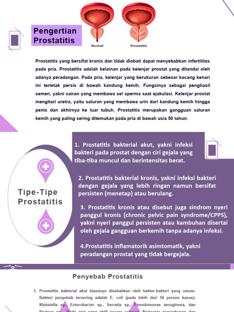 Ciri-Ciri dan Pengobatan Prostatitis | PDF | Kesehatan Holistik
