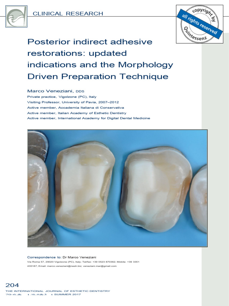 Posterior indirect adhesive | PDF | Medical Specialties | Mouth