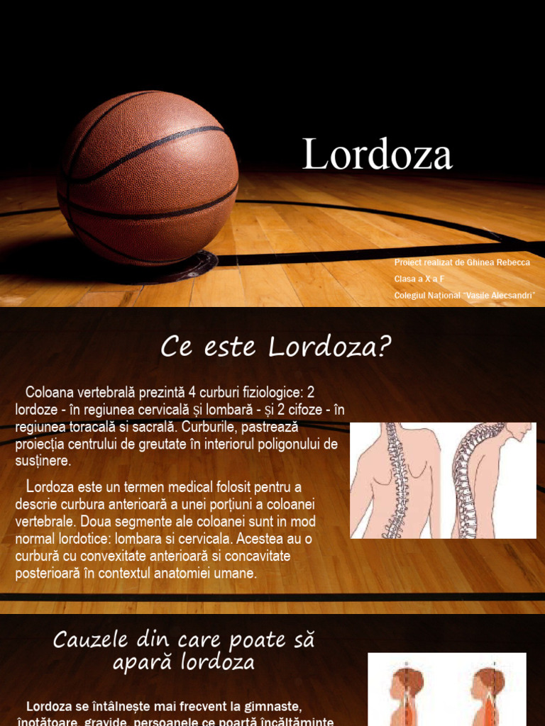 Lordoza | PDF