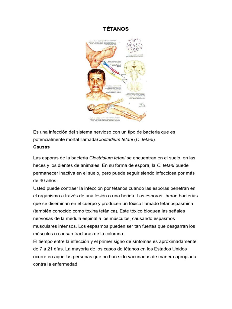 TÉTANOS | PDF | Especialidades Medicas | Enfermedades y trastornos