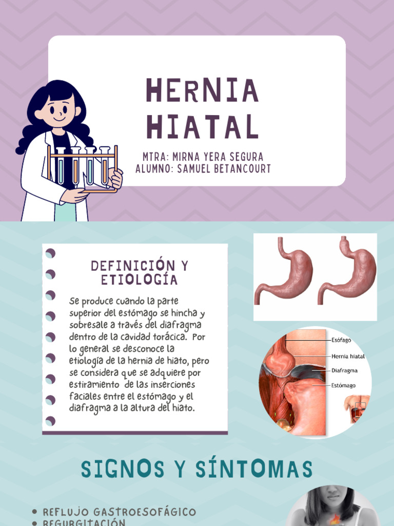 Hernia Hiatal Presentación | PDF
