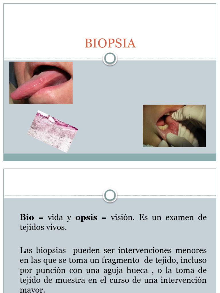 Expo Biopsia | PDF | Biopsia | Cáncer