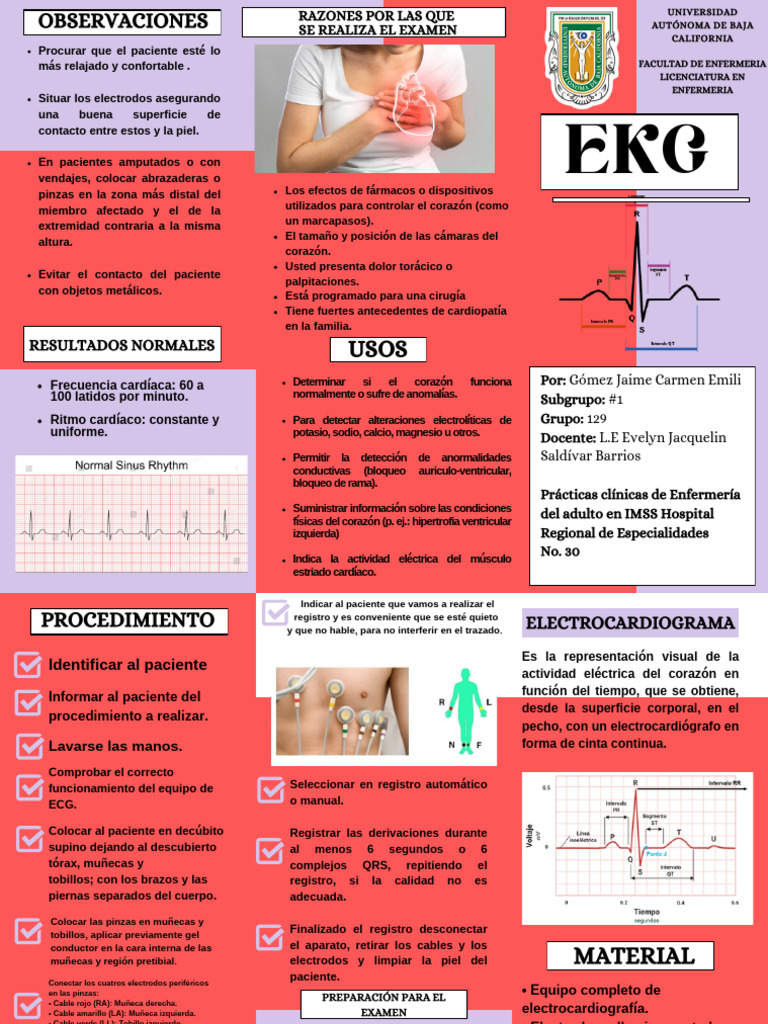 Guía Completa para Realizar un EKG | PDF