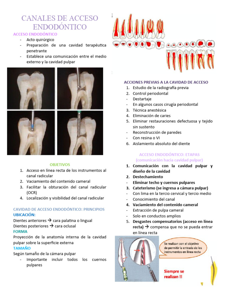 CANALES DE ACCESO ENDODÓNTICO | PDF