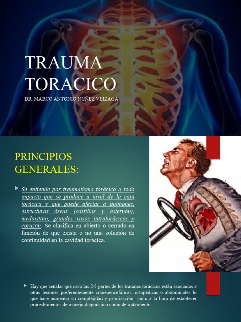 Trauma Toracico | PDF