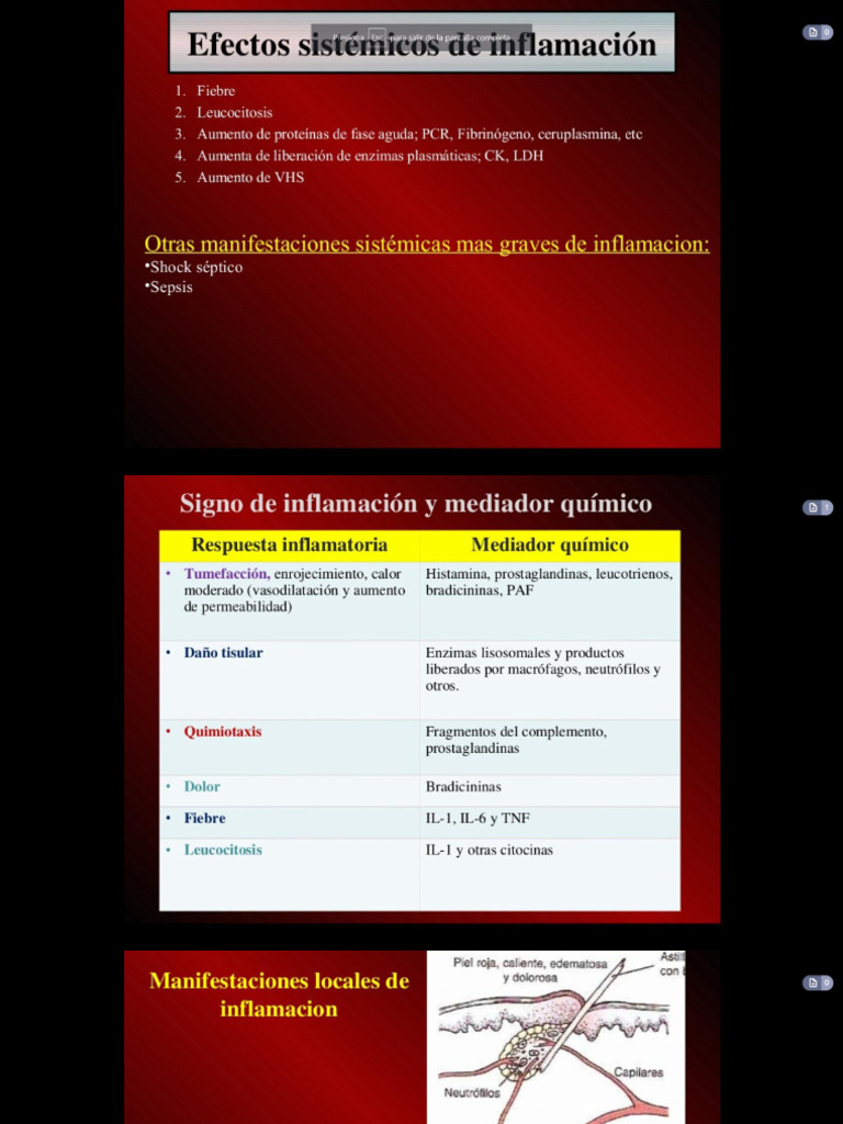 Efectos Sistemicos de La Inflamacion | PDF