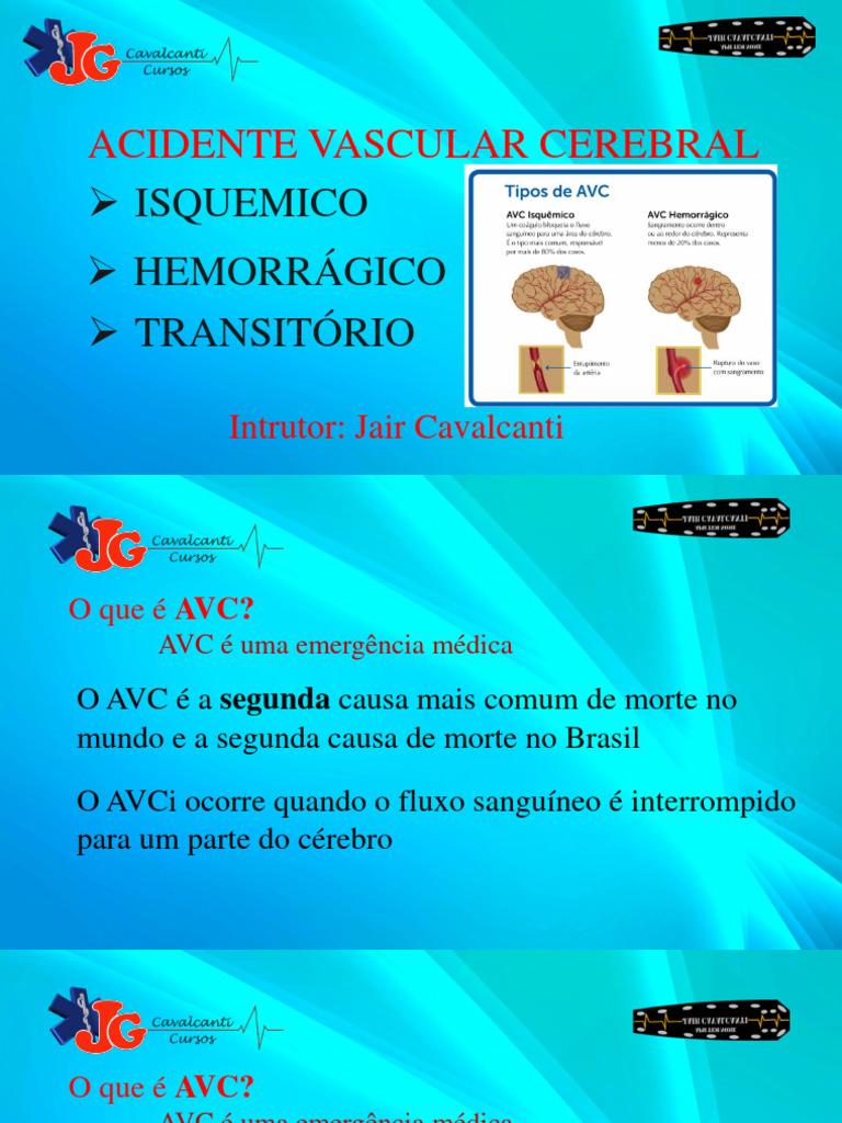 Acidente Vascular Cerebral: Isquemico Hemorrágico Transitório | PDF