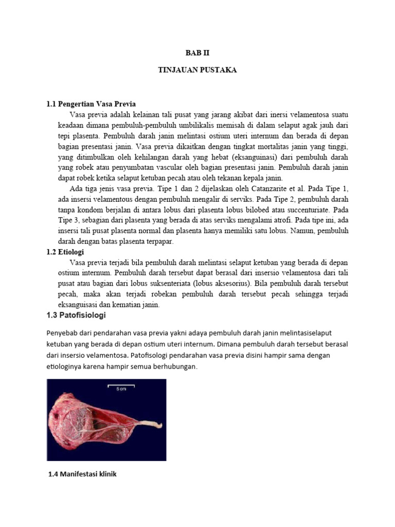 Bab 2 Vasa Previa | PDF