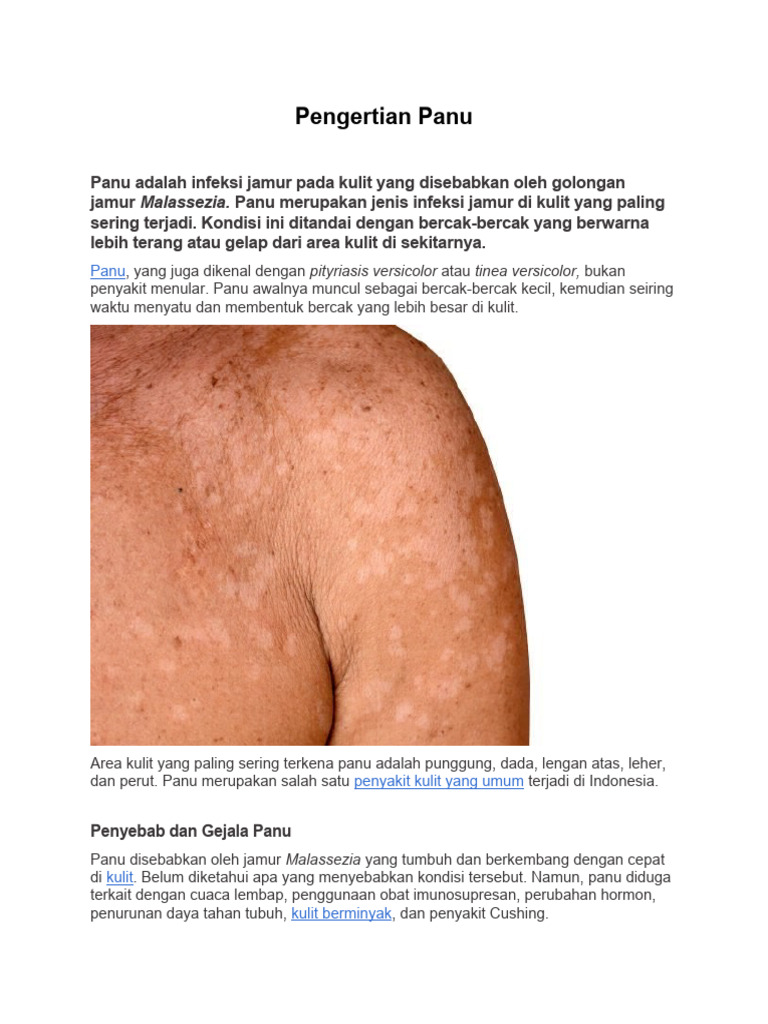 Penyakit Panu | PDF