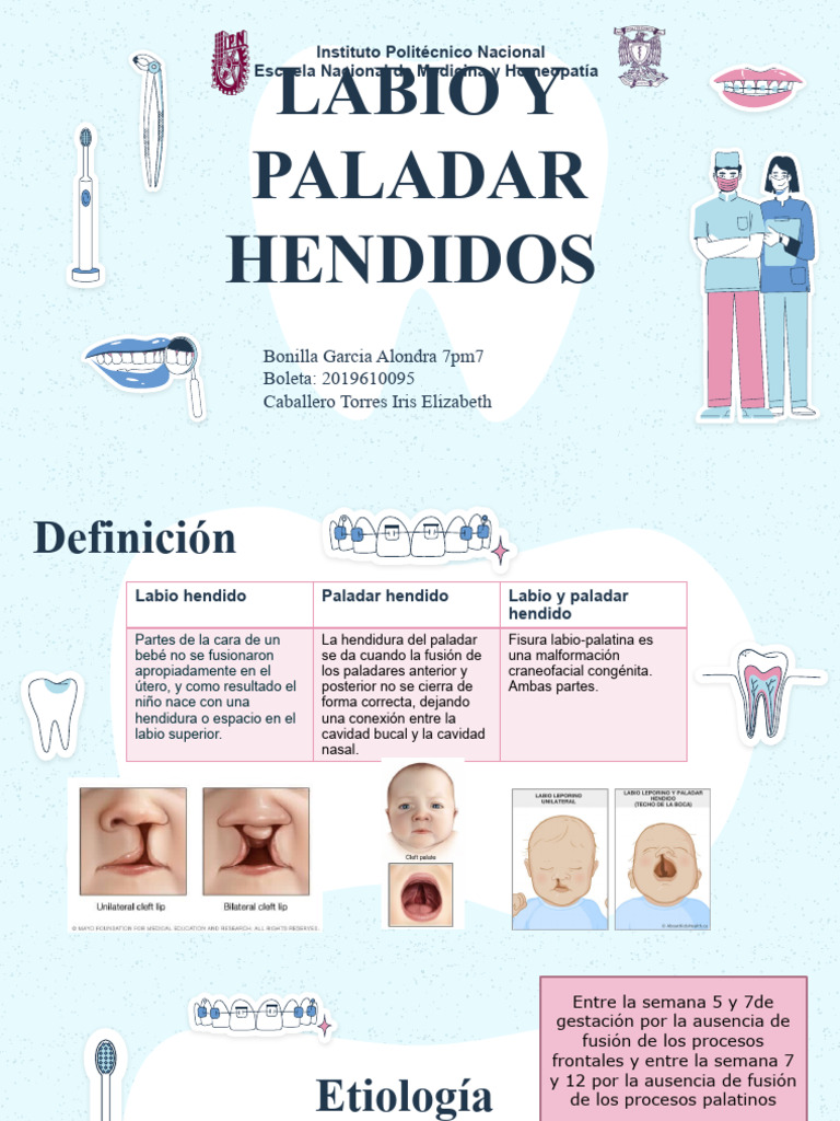 Labio y Paladar Hendido: Causas y Tratamiento | PDF