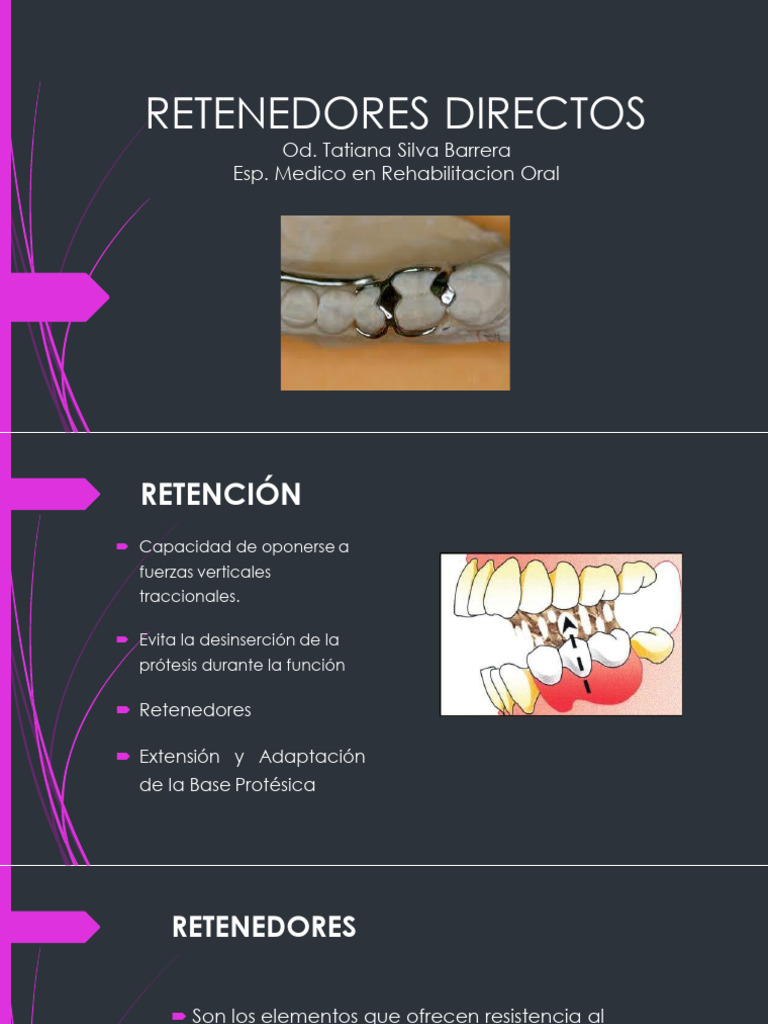 RETENEDORES DIRECTOS | PDF | Dentadura postiza | Diente