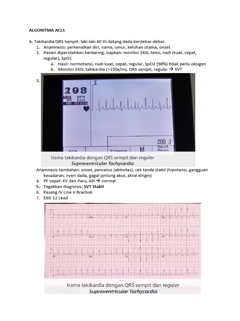 Algoritma Acls | PDF