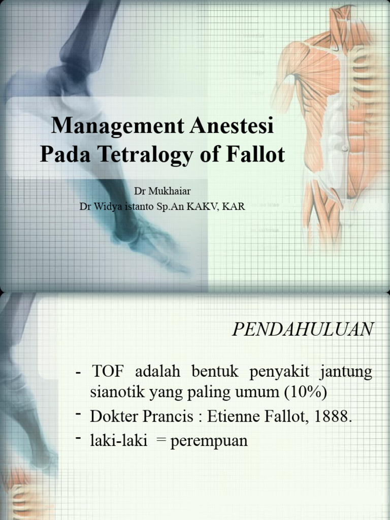 Management Anestesi Pada Tetralogy of Fallot | PDF Management Anestesi Pada Tetralogy of Fallot | PDF