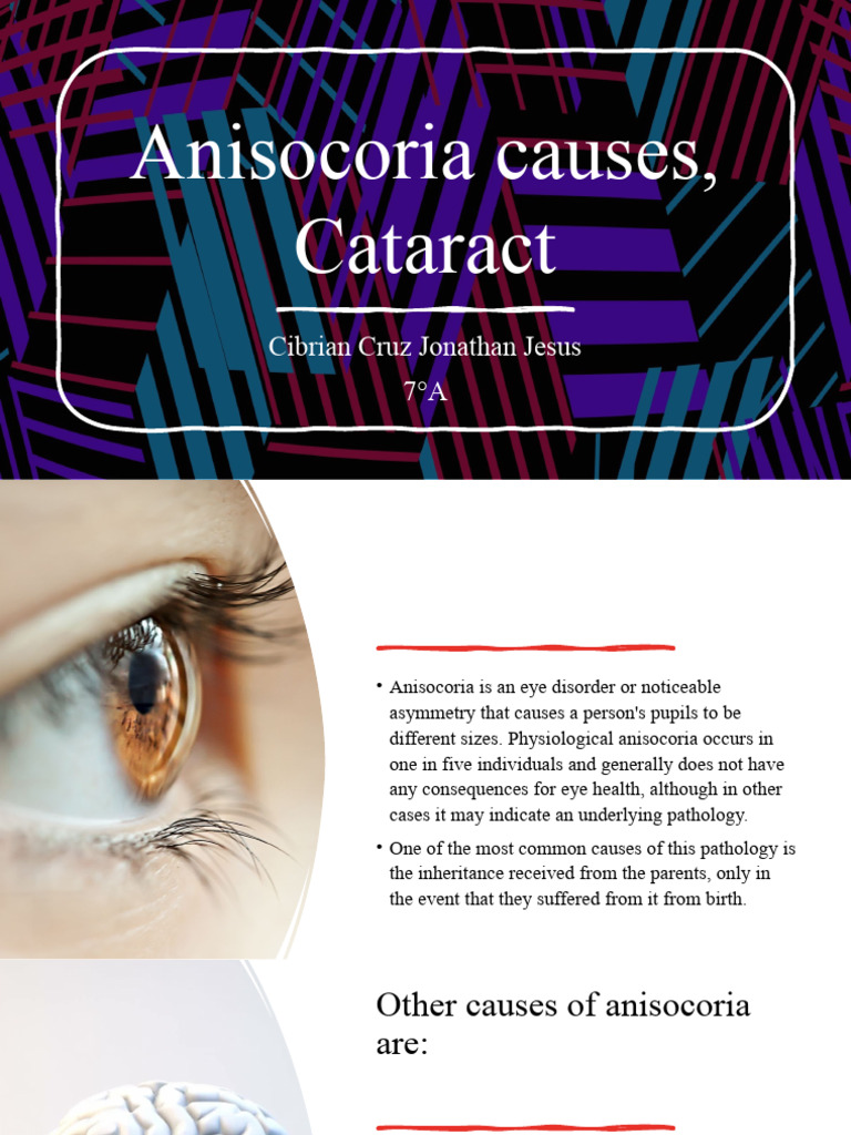 Anisocoria Causes, Cataract | PDF