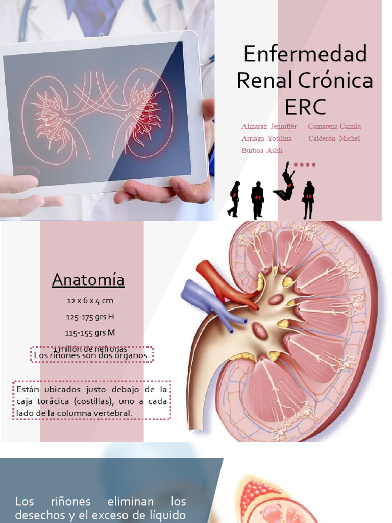 Enfermedad Renal Crónica ERC | PDF