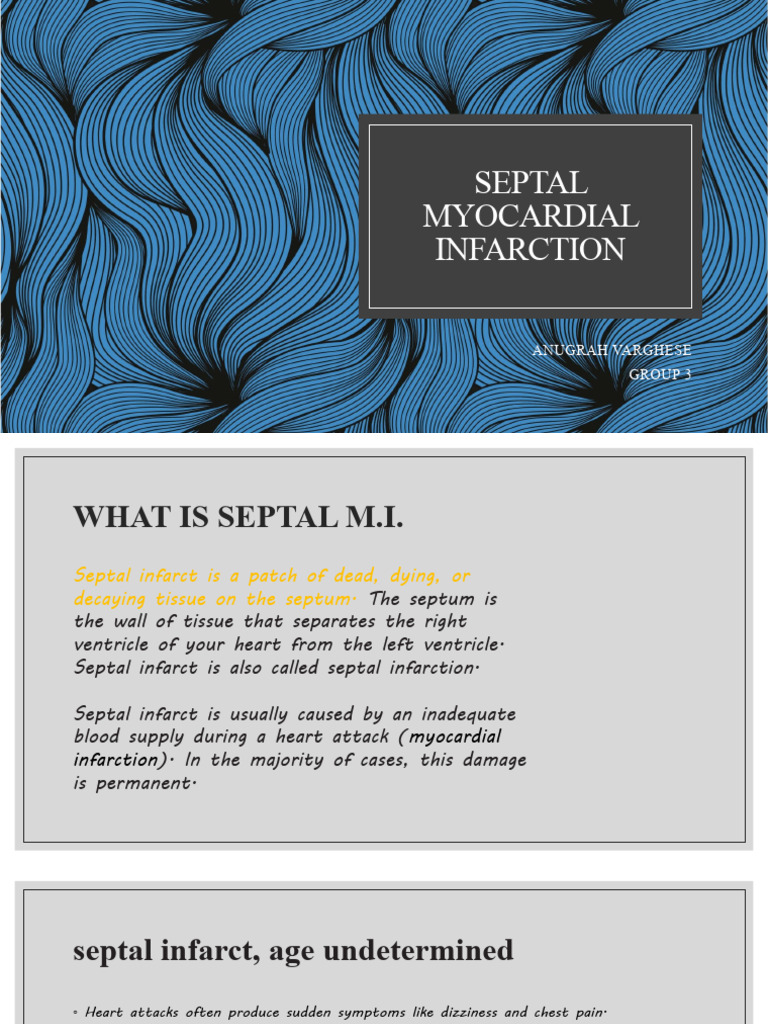 Septal Myocardial Infarction | PDF