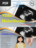 Mola Hidatiforme Definicion Etiologia Fisiopatologia Diagnostico ...