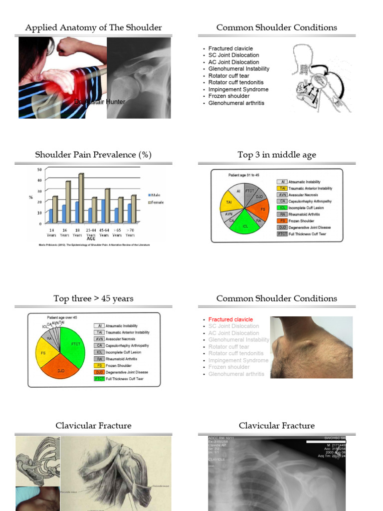 Applied Anatomy of The Shoulder | PDF | Shoulder | Clinical Medicine
