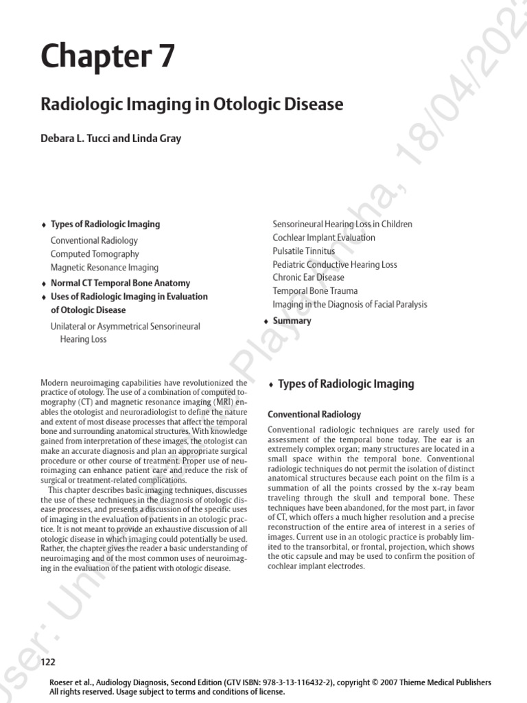 Temporal Bone Fracture | PDF
